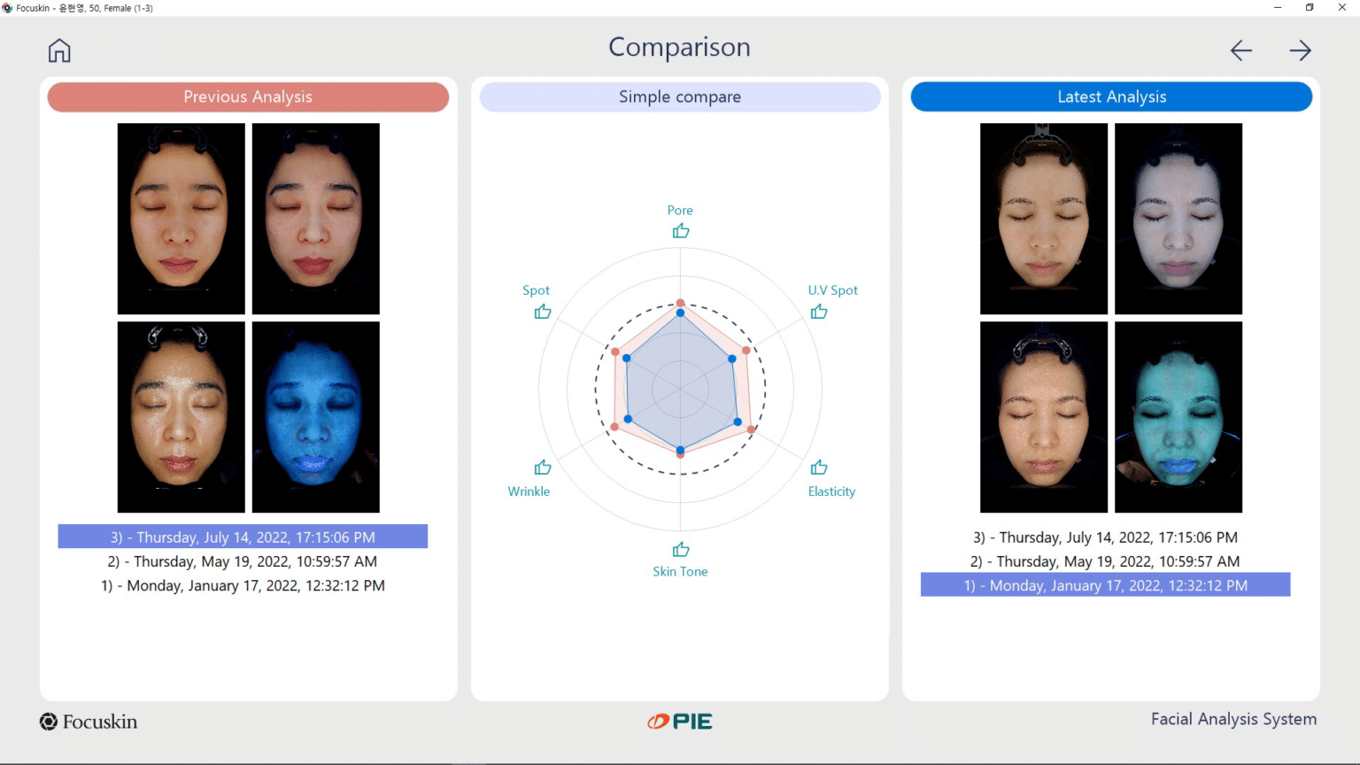 ImagePro Halo: 3D Skin Analyzer Machine | Emage Medical