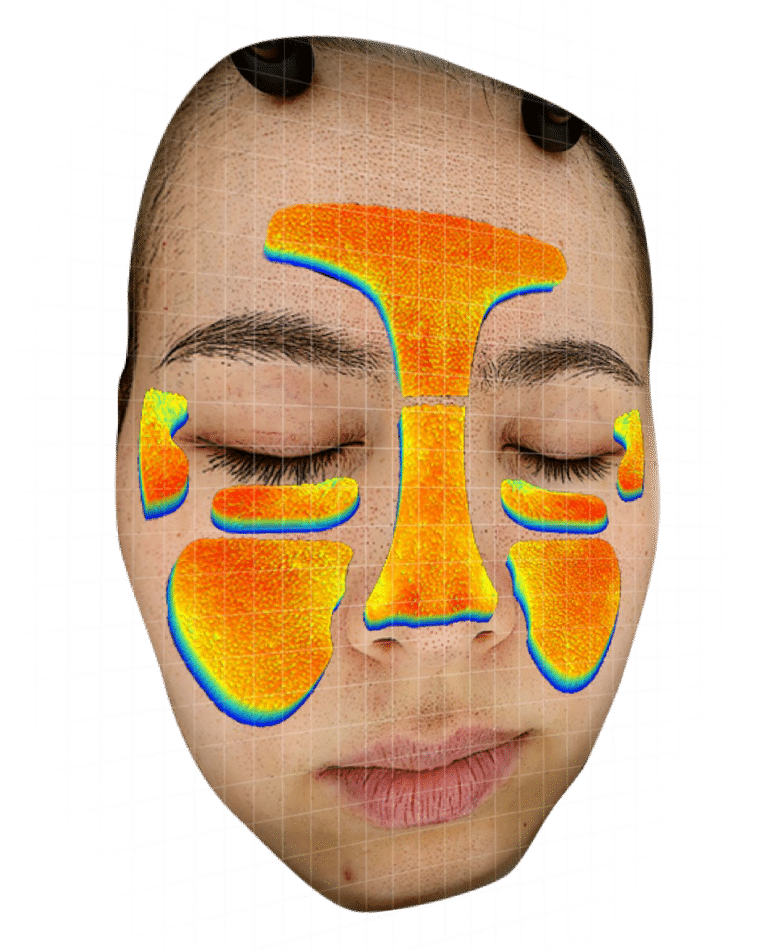 ImagePro Halo: 3D Skin Analyzer Machine | Emage Medical