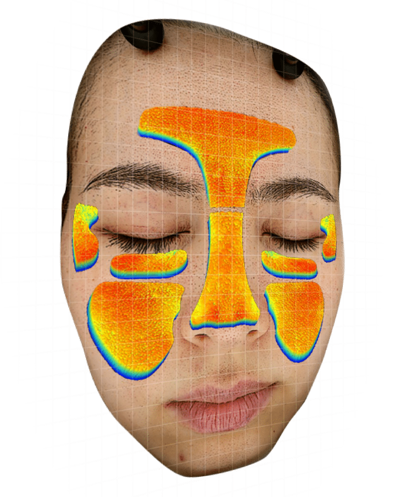 ImagePro Halo: 3D Skin Analyzer Machine | Emage Medical